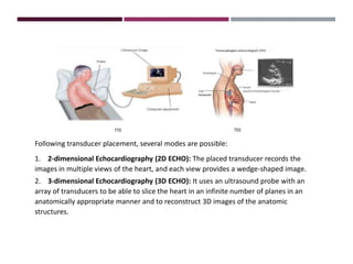 Cardiovascular tests | PPTX