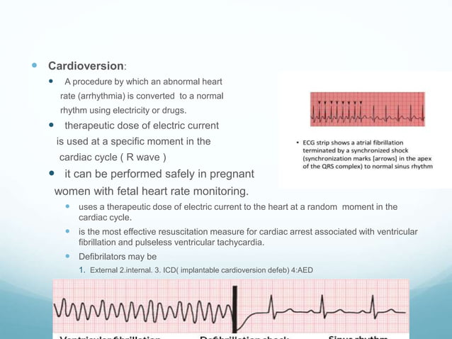 Cardioversion | PPTX | Heart and Cardiovascular Diseases | Diseases and ...
