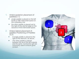 Cardioversion | PPTX