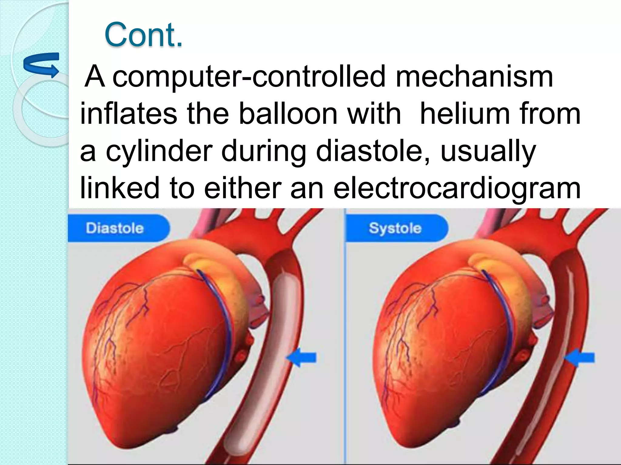 Cardioversion.pptx
