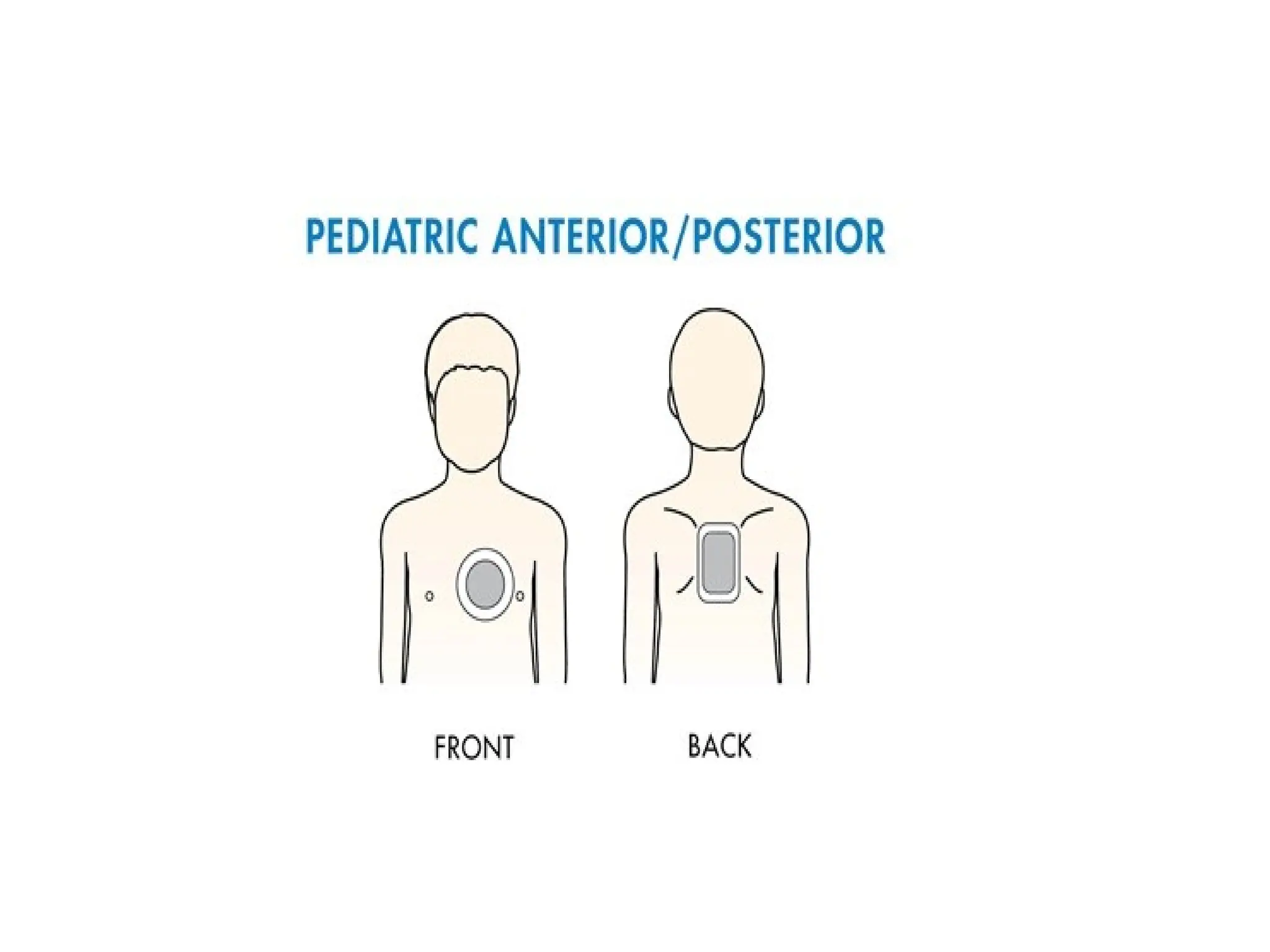 cardioversion and defibrillation نذير.pptx