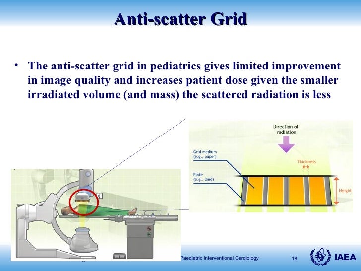 Radiation Protection in Paediatric Interventional Cardiology