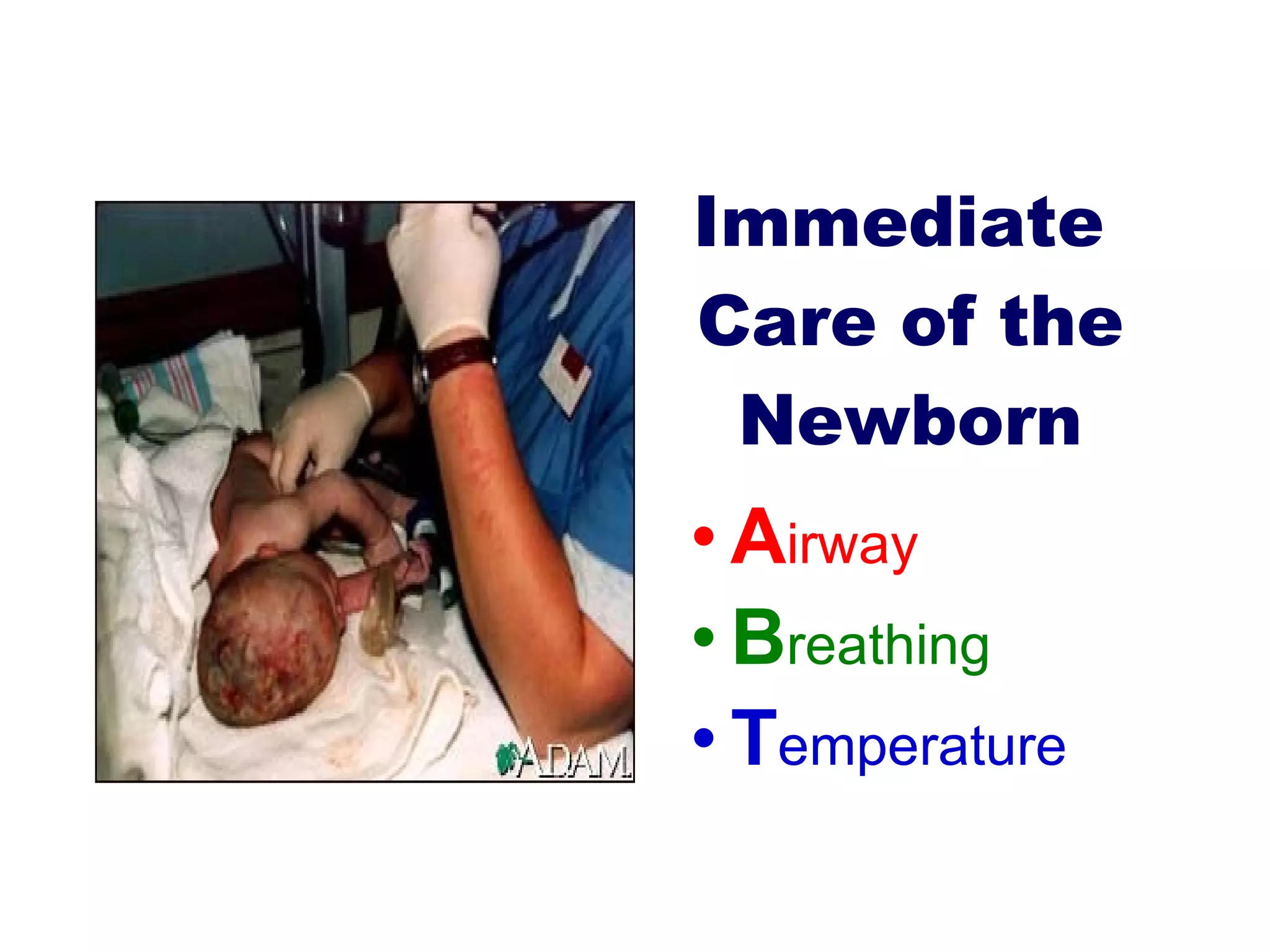 Care Of The Newborn | PPT | Pregnancy | Reproductive Health