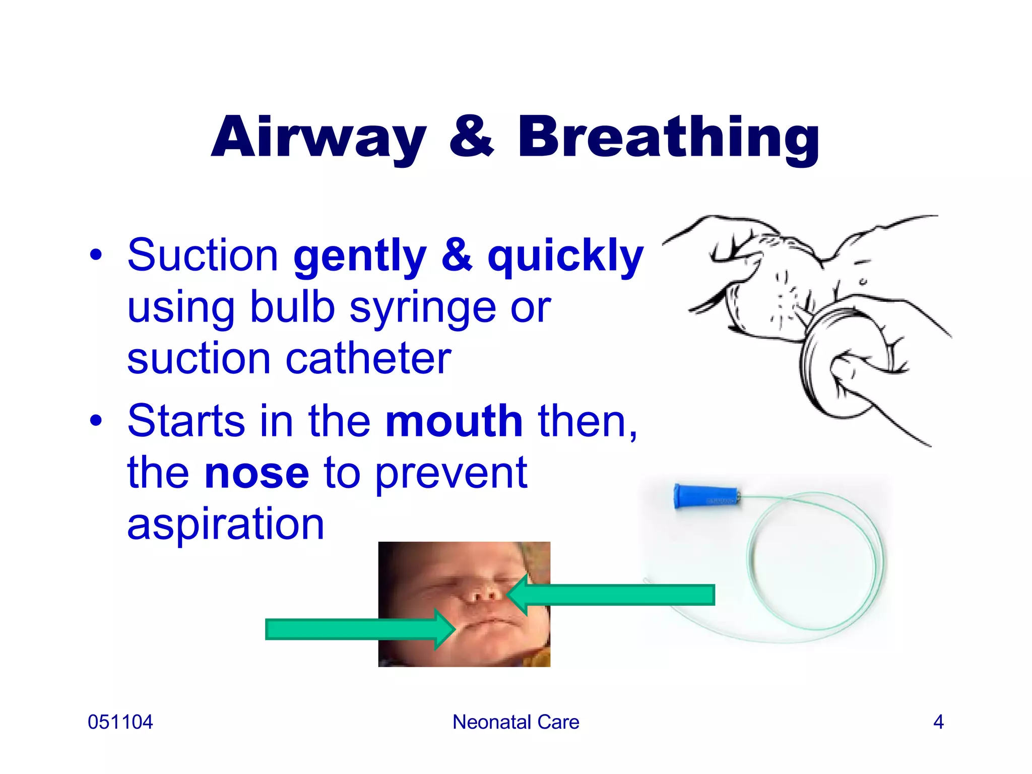 Care Of The Newborn | PPT