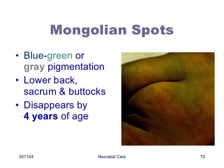 DR. TRINADH – DCH – Study Material