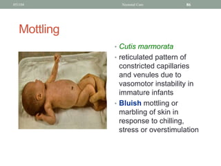 Nursing of a family care-of-the-newborn.ppt