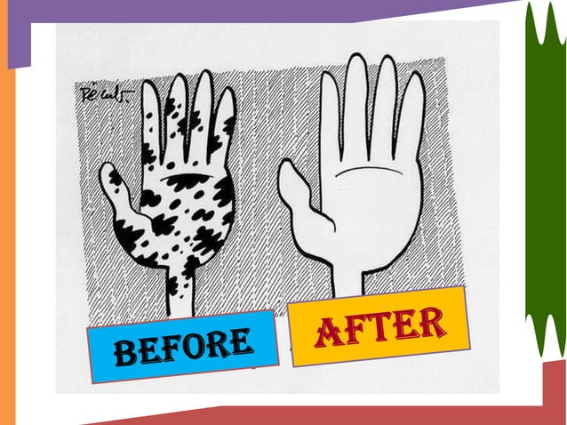 PREVENTION OF HAI : CARE BUNDLE APPROACH | PDF | Lung and Respiratory ...