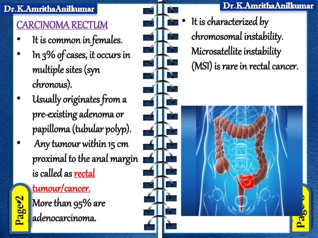Carcinoma Rectum by Dr.K.AmrithaAnilkumar | PPTX
