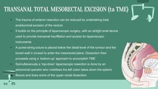 MANAGEMENT OF RECTAL CARCINOMA.pptx