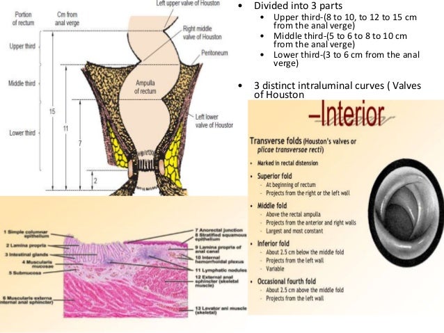 Ca rectum premanagement
