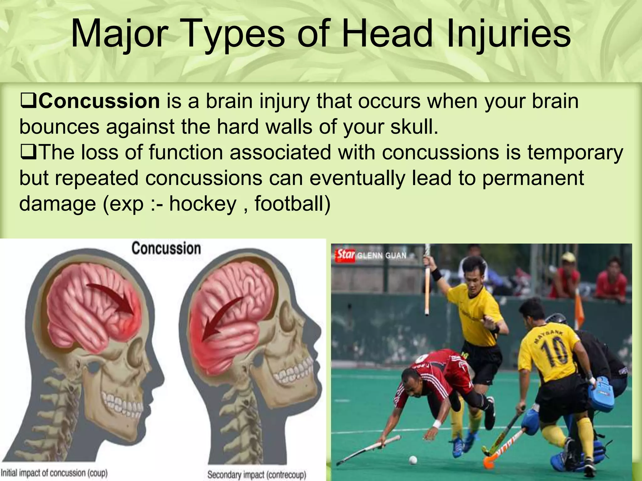 Care of patient with head injury | PPTX