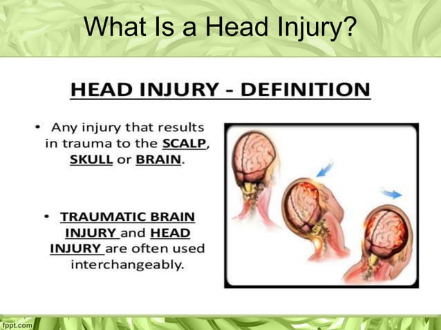 Care of patient with head injury | PPTX | Death, Injury, or Military ...