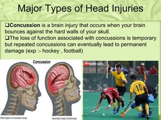 Care of patient with head injury | PPTX