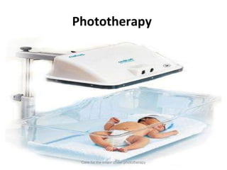Care for the child uderphototherapy | PPT