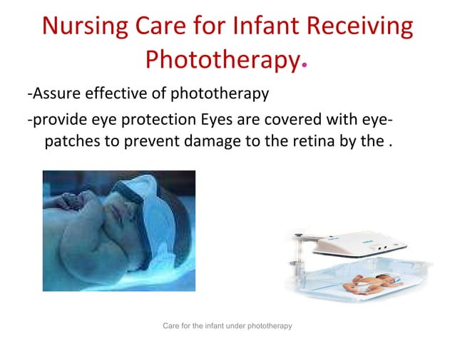 Care for the child uderphototherapy | PPT | Pregnancy | Reproductive Health