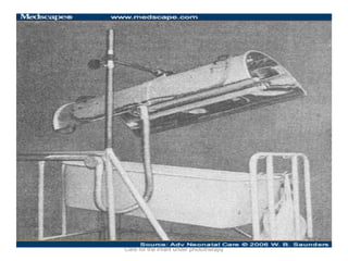 Care for the child uderphototherapy | PPT