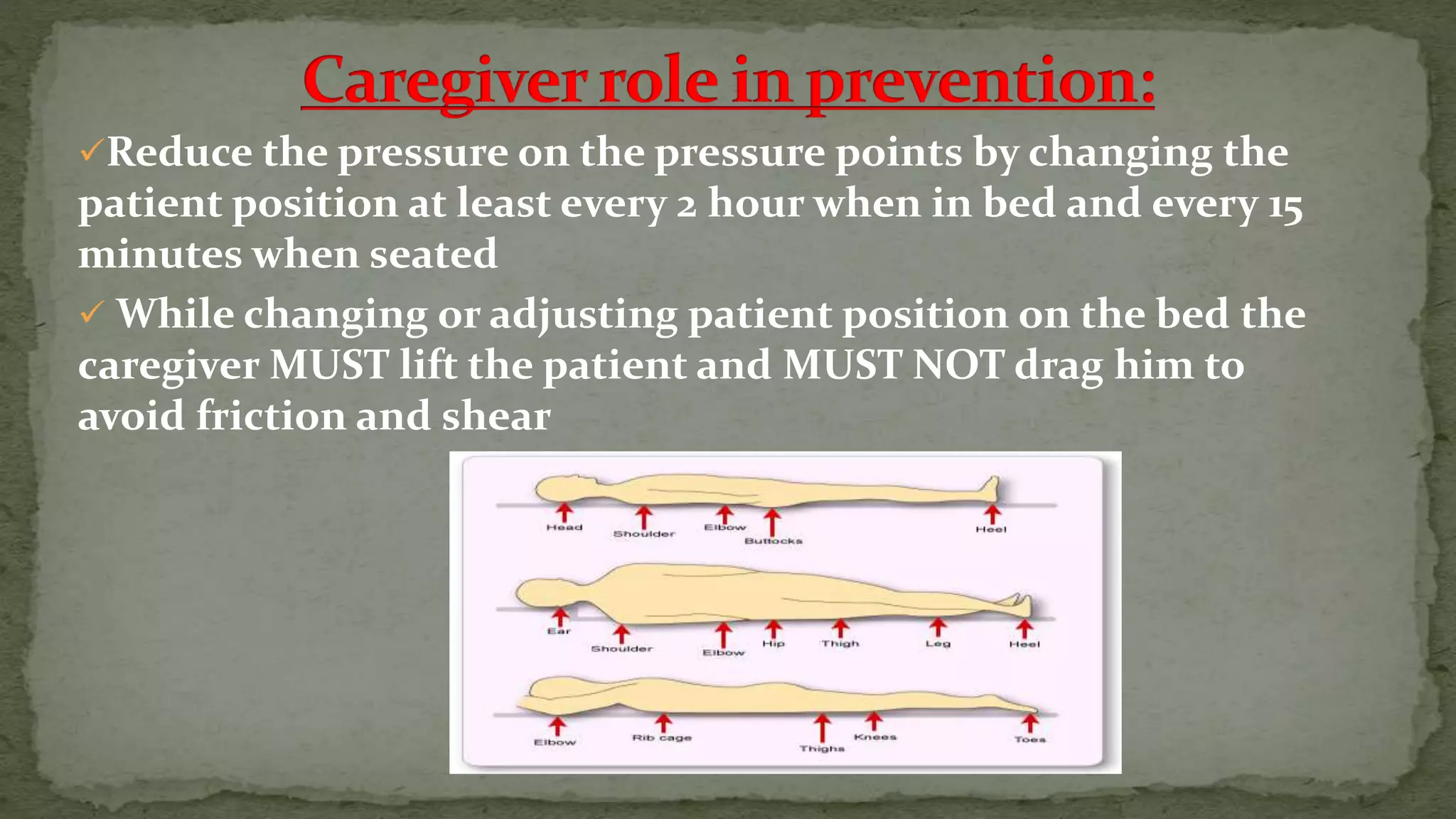 Caregiver role in prevention and management of pressure ulcer | PPTX