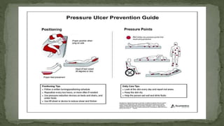 Caregiver role in prevention and management of pressure ulcer | PPTX