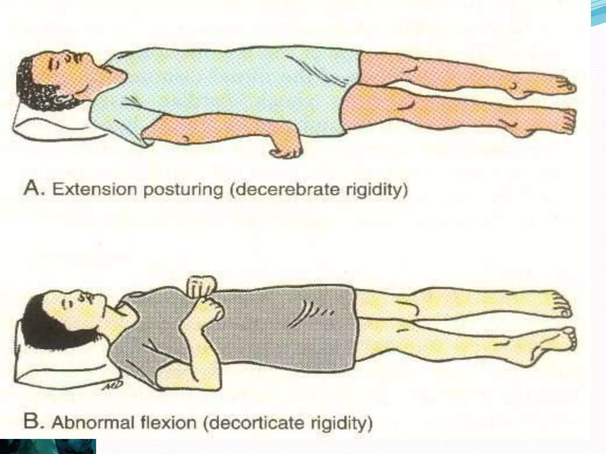 Care of an unconcious patient | PPTX