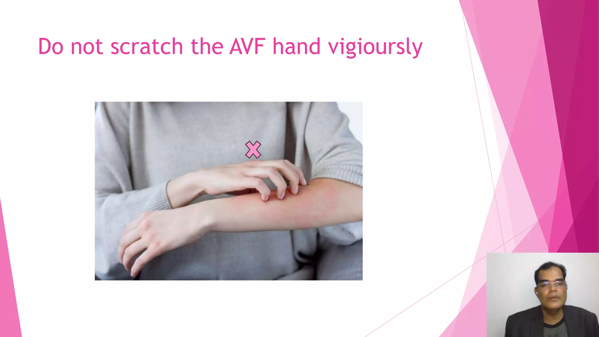 Care of AV Fistula (with explanation on download).pptx