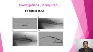 Care of AV Fistula (with explanation on download).pptx