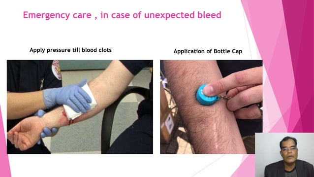 Care of AV Fistula (with explanation on download).pptx | First Aid ...