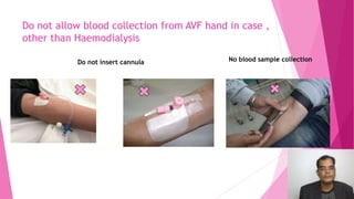 Care of AV Fistula (with explanation on download).pptx