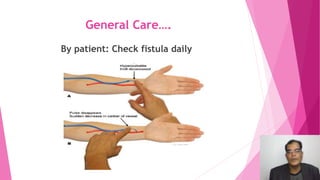 Care of AV Fistula (with explanation on download).pptx