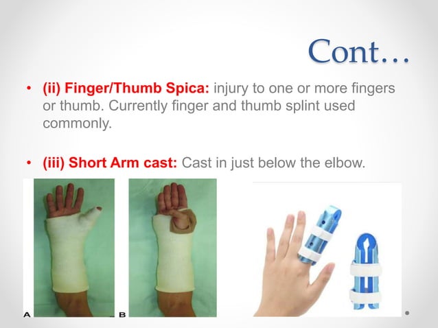 Care of Bed ( Plaster cast & Traction)- ridden Patient.pptx