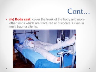 Care of Bed ( Plaster cast & Traction)- ridden Patient.pptx