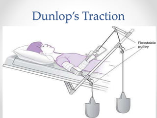 Care of Bed ( Plaster cast & Traction)- ridden Patient.pptx