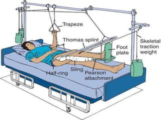 Care of Bed ( Plaster cast & Traction)- ridden Patient.pptx