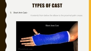 Care of bedridden patient [cast] | PPTX