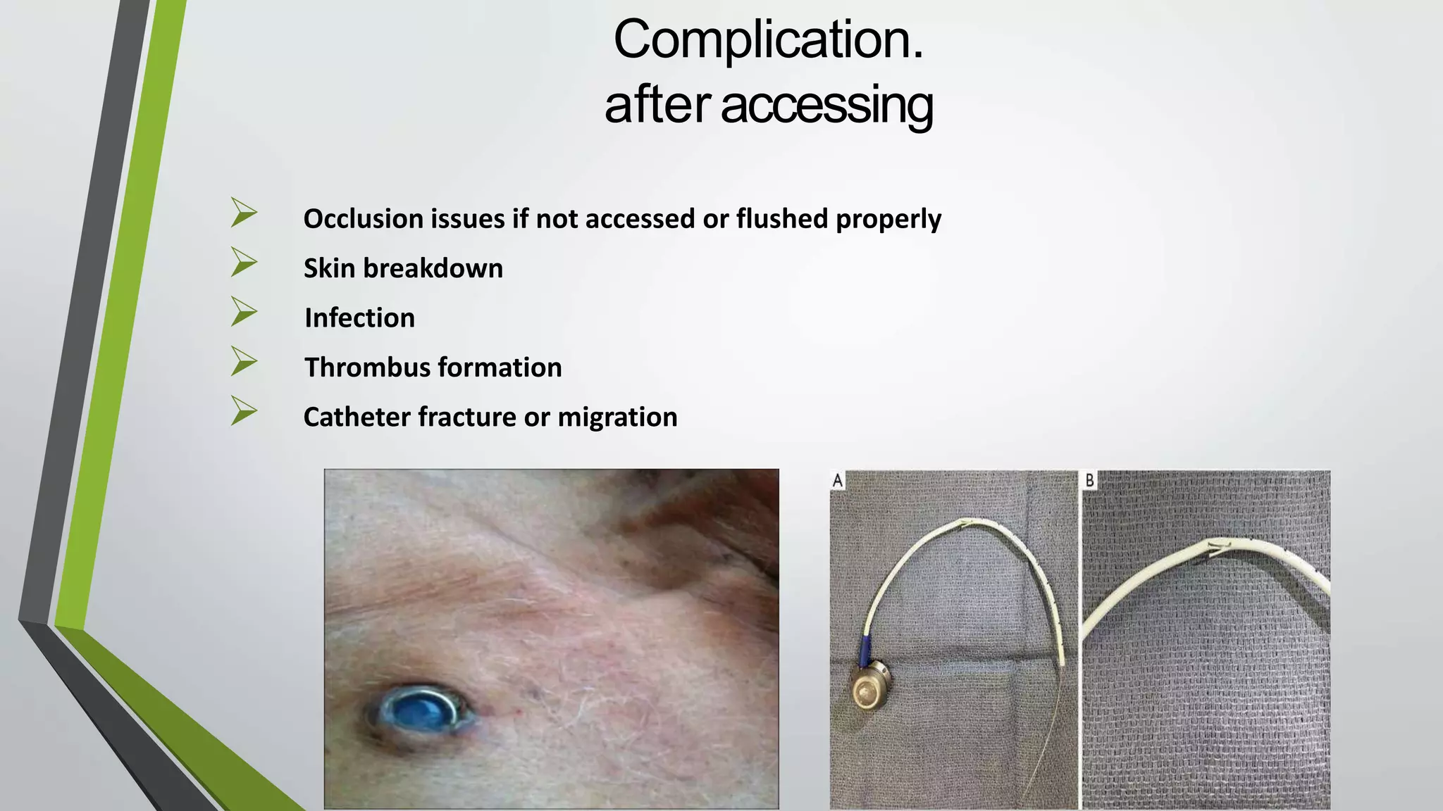 care of chemoport.pptx