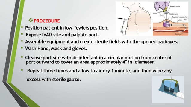 care of chemoport.pptx | Pharmaceutical Drugs | Medical Health