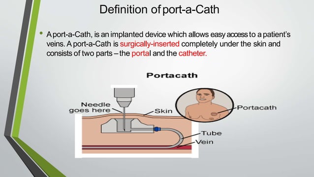 care of chemoport.pptx | Pharmaceutical Drugs | Medical Health
