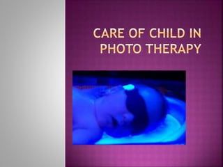 Care of child in photo therapy | PPTX