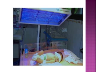 Care of child in photo therapy | PPTX