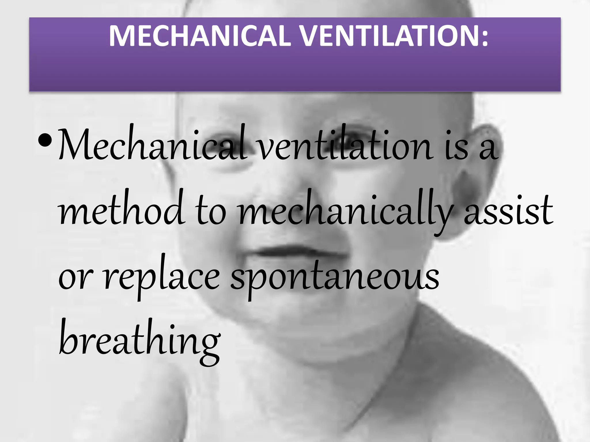 Care of child requiring long term ventilation | PPTX