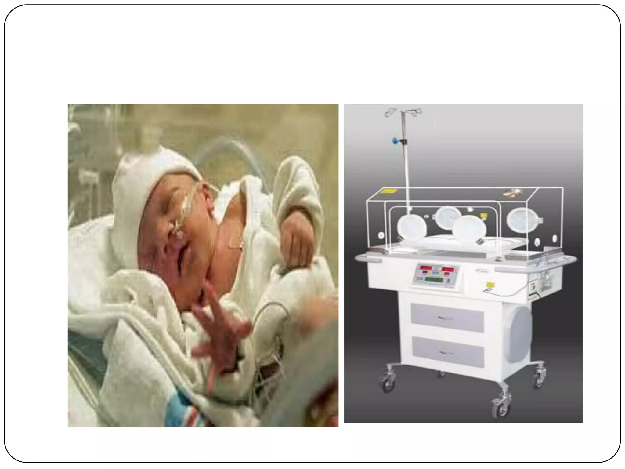 Care of child with incubator | PPTX