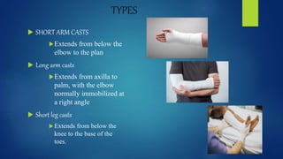 Care_of_clients_with_cast_and_splints.pptx