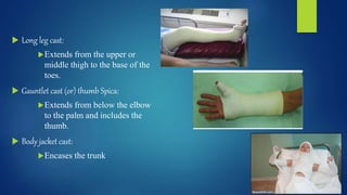 Care_of_clients_with_cast_and_splints.pptx