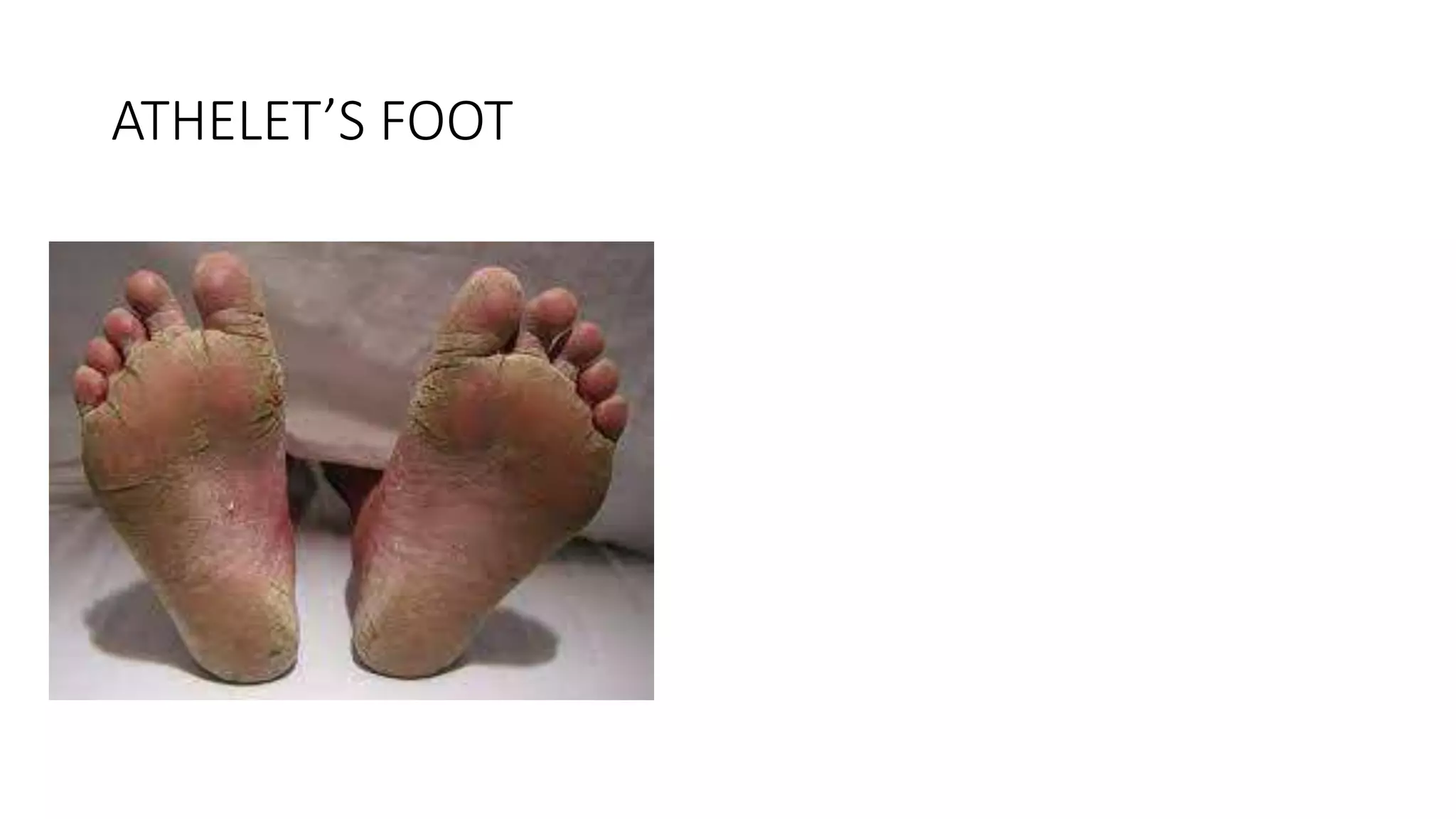 CARE OF HAND AND FEET.pptx