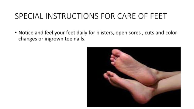 CARE OF HAND AND FEET.pptx