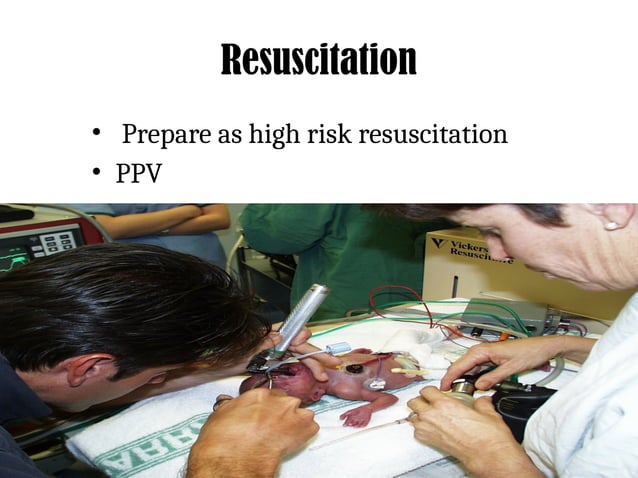 CARE OF LOW BIRTH WEIGHT BABY children.pptx