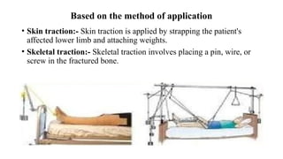 Care of patient Skin and Skeletal Traction.pptx