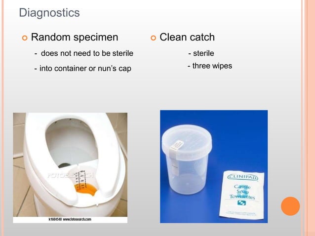 Care of patients with elimination needs | PPTX | Digestive Disorders ...