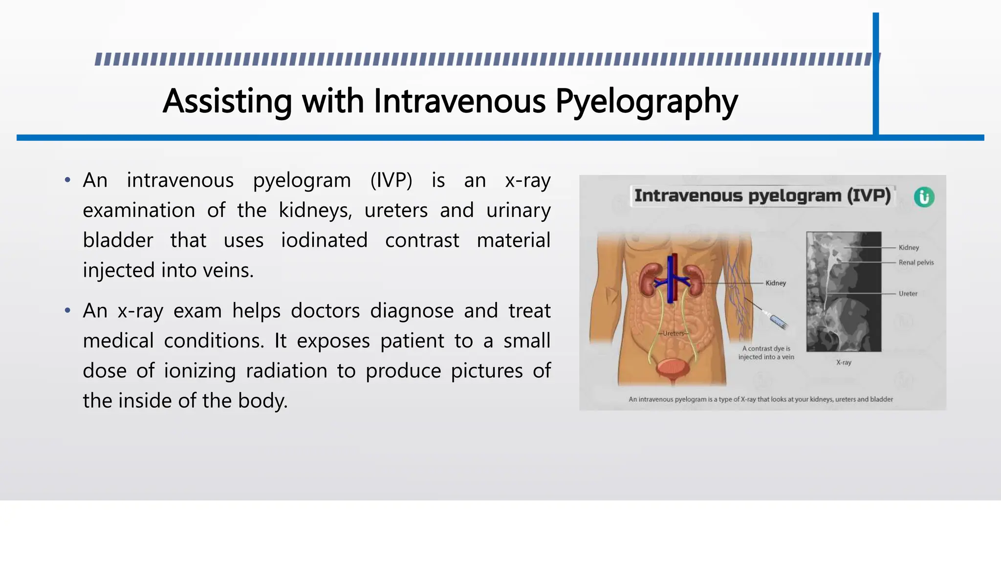 Care of patients with renal biopsy and IVPpptx | PPTX