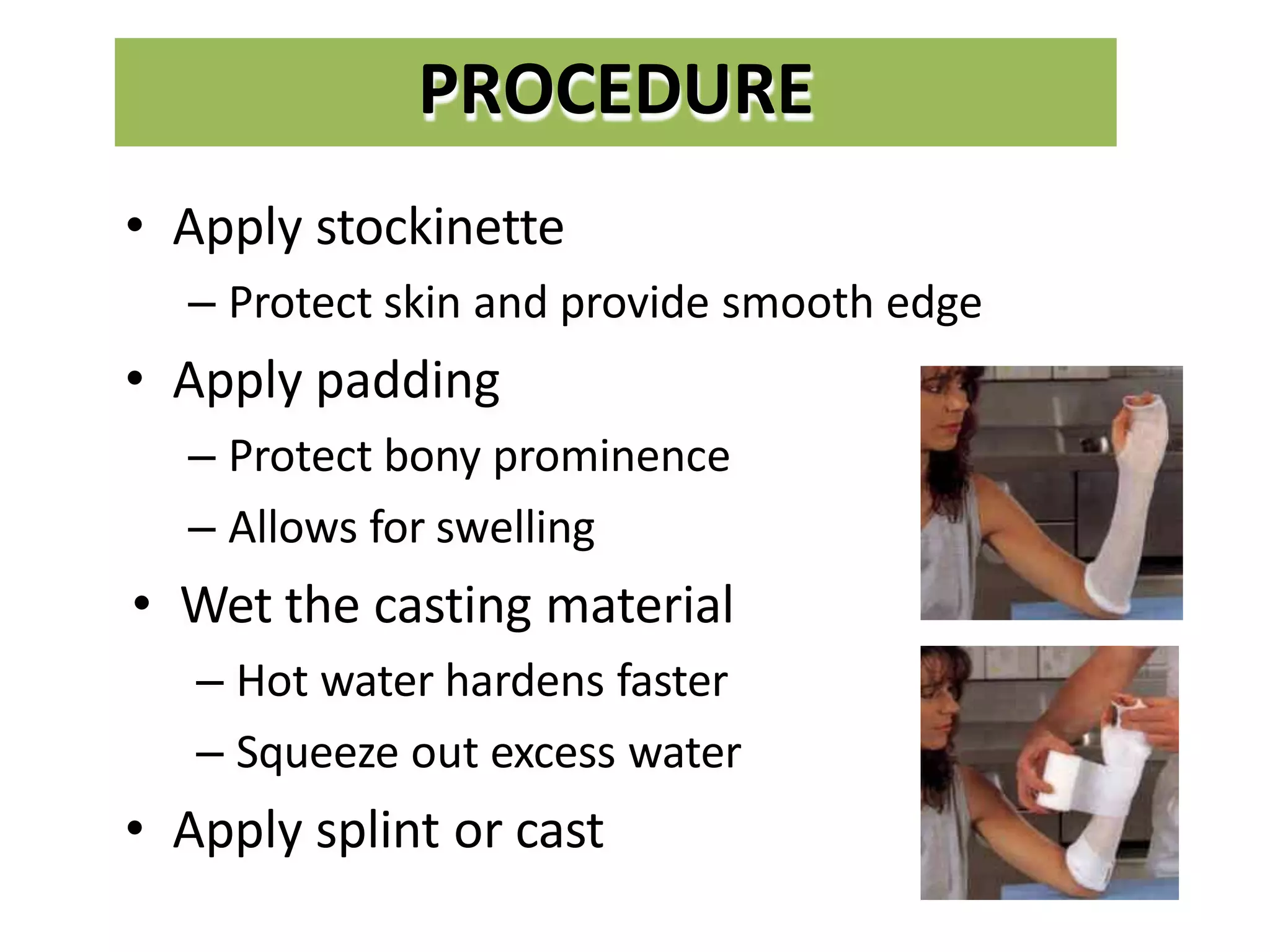 care of patient with cast.pptx
