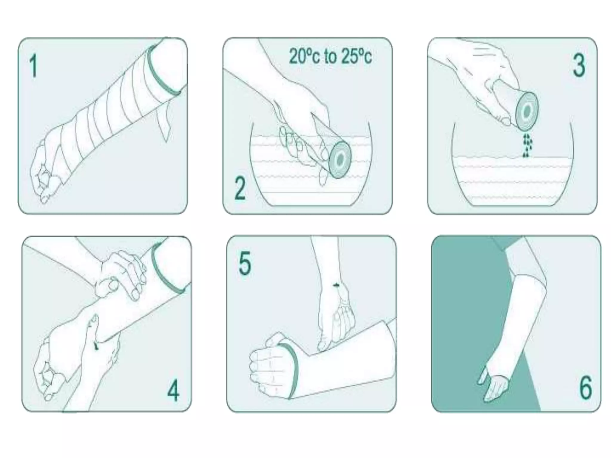 care of patient with cast.pptx